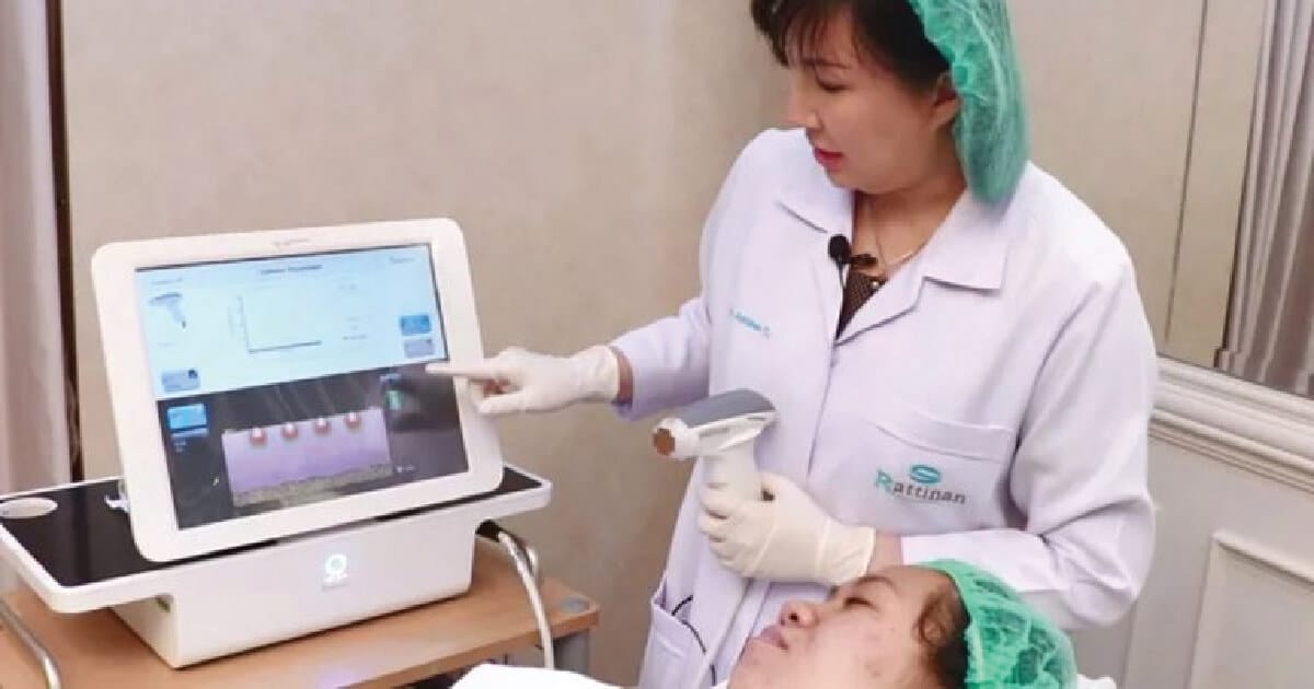 eMatrix: Smooth Skin, Treat Acne Scars—Safe & Affordable!