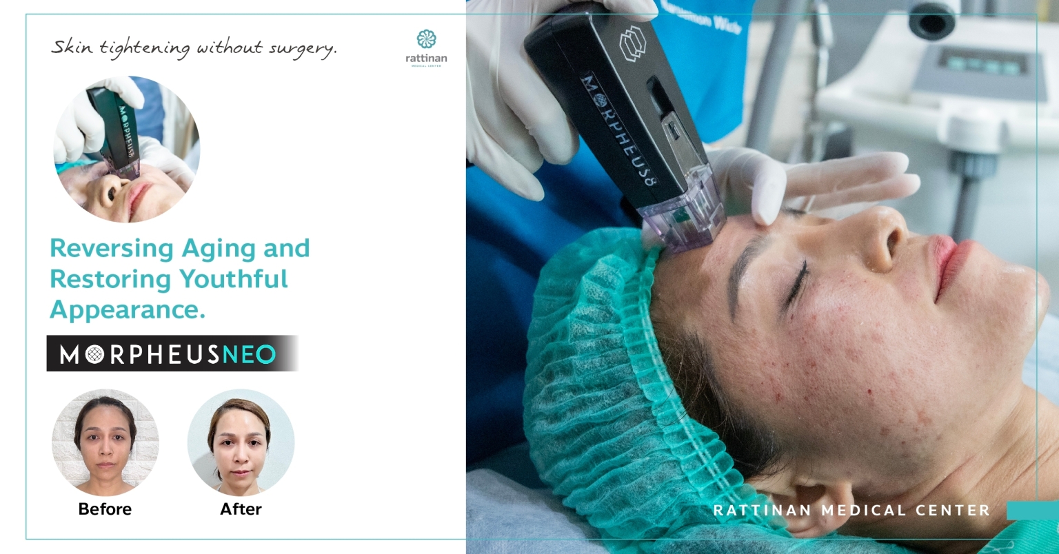 Morpheus NEO : Revitalize Your Skin, Smooth Wrinkles, and Firm Sagging ...