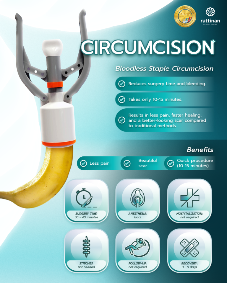 Should You Consider Staple Circumcision in Bangkok?
