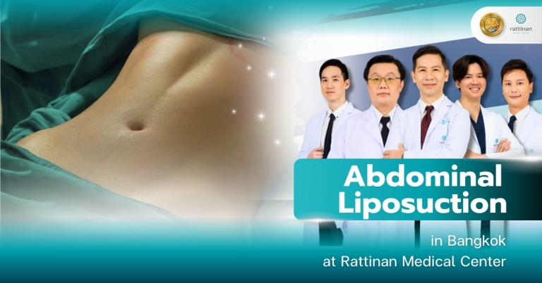 Abdomen (Stomach) Liposuction in Thailand