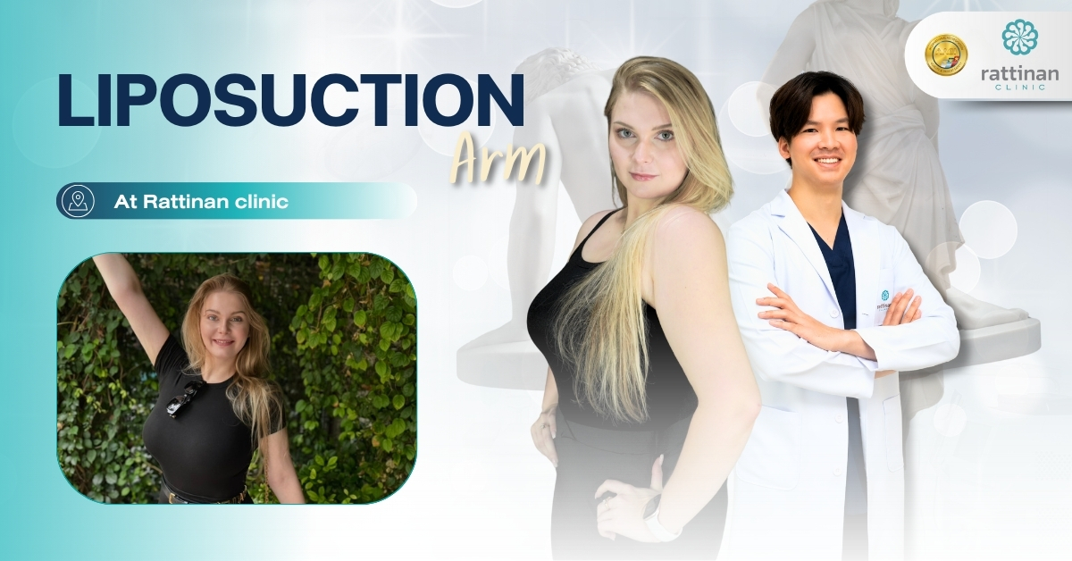 Varvara’s Arm Liposuction Revision Review in Thailand | Rattinan Clinic