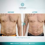 Tesla Former สร้างกล้ามเนื้อ สลายไขมัน กระชับสัดส่วน ปั้นหุ่นเฟิร์ม ไม่ ...