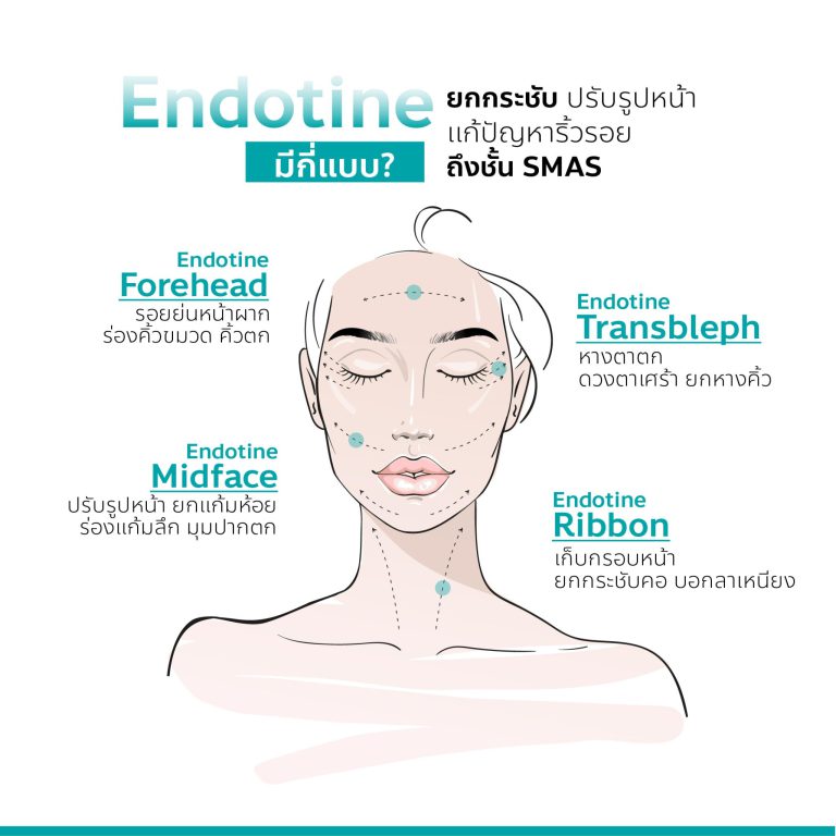 Endotine เทคโนโลยี ยกกระชับใบหน้า แผลเล็ก ปลอดภัย โดย อจ.จตุพร