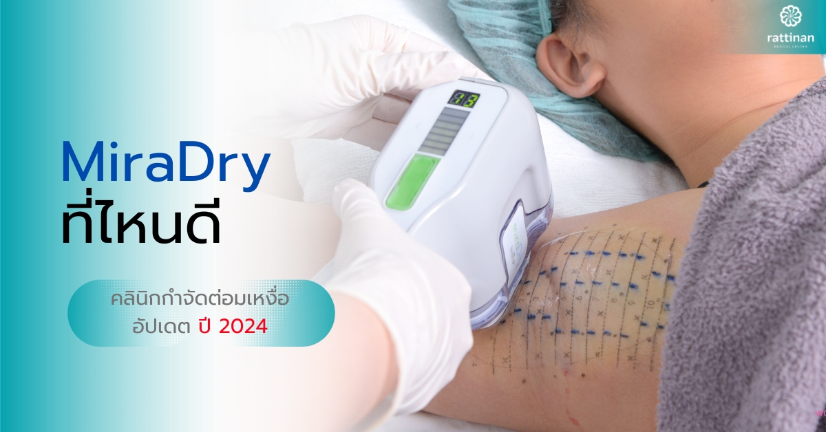 คลินิกเลเซอร์ต่อมเหงื่อ miraDry ที่ไหนดี อัปเดต ปี 2024 - Rattinan Medical Center