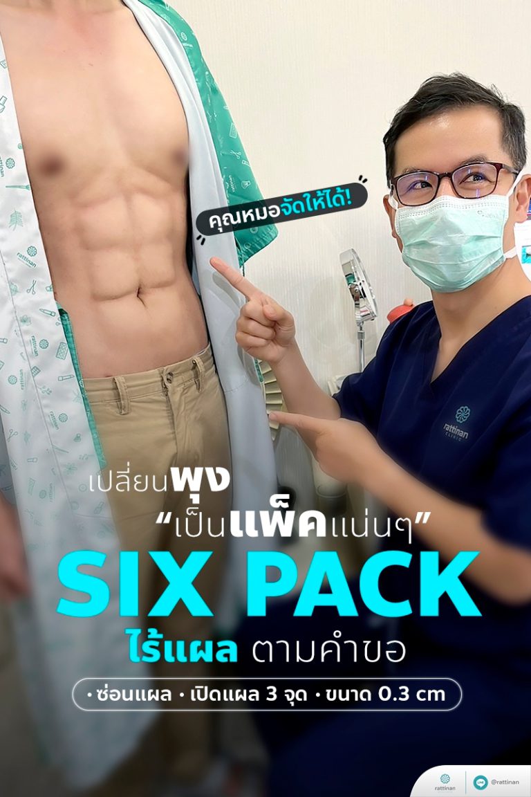 ศัลยกรรมผู้ชาย ปี 2023 ทำส่วนไหนบ้าง? เสริมหล่อให้เป๊ะปังทั้งหน้าและตัว