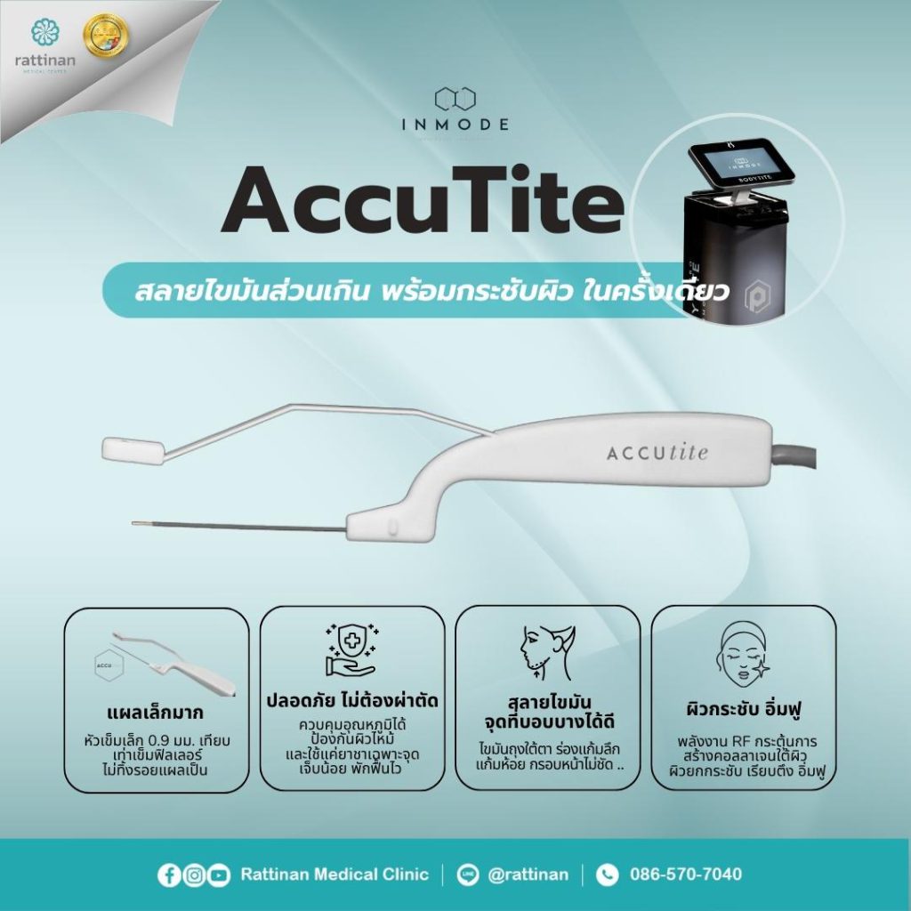 AccuTite ลดไขมันแก้ม ไขมันใต้ตา พร้อมกระชับผิวในครั้งเดียว ไม่มีรอยแผลเป็น